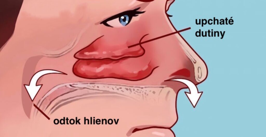 Jak uvolnit ucpané dutiny pouze s pomocí vašich prstů | iRecept.cz